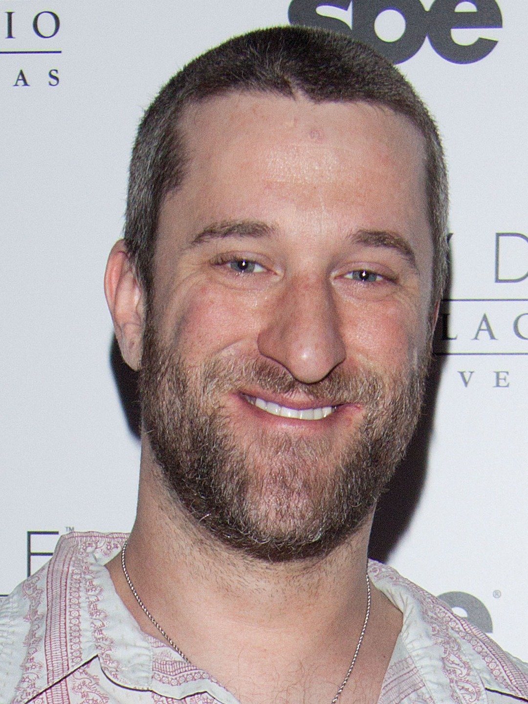 Why didn't Dustin Diamond get a nose job?