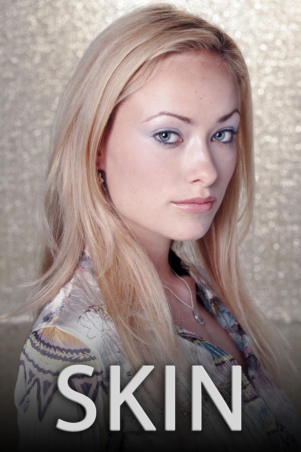Skin (TV series) - Alchetron, The Free Social Encyclopedia